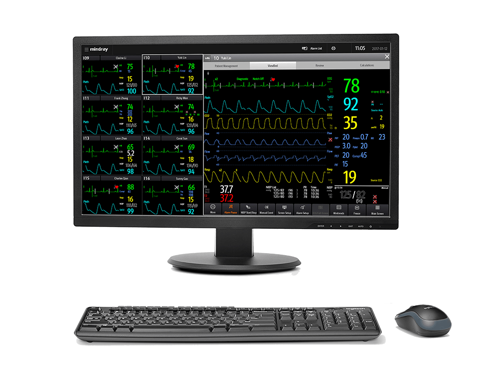 BeneVision CMS - Zentrales Überwachungssystem - Mindray Deutschland