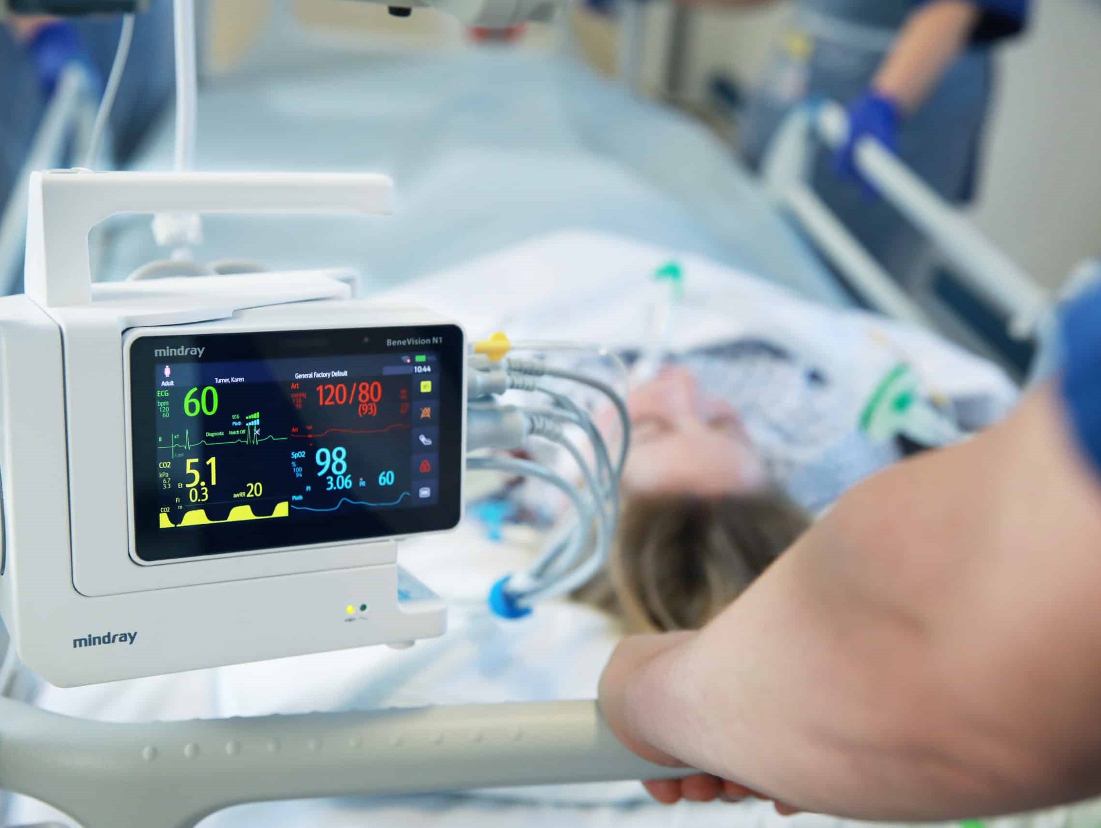 BeneVision N1 - Patientenmonitor - Mindray Deutschland