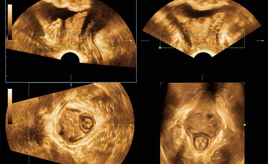 Inspiring Women’s Healthcare - ISUOG 2022 - Mindray Global