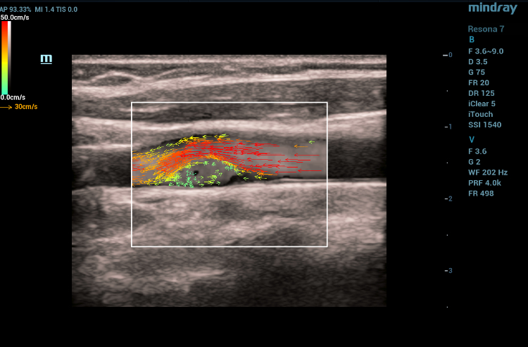 Asset download - Mindray