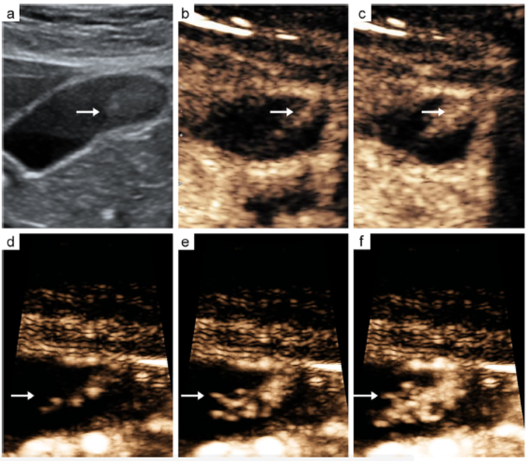Asset download - Mindray