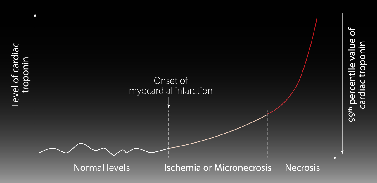 hs-cTnI: Empowering Heart Risk Assessment - Mindray