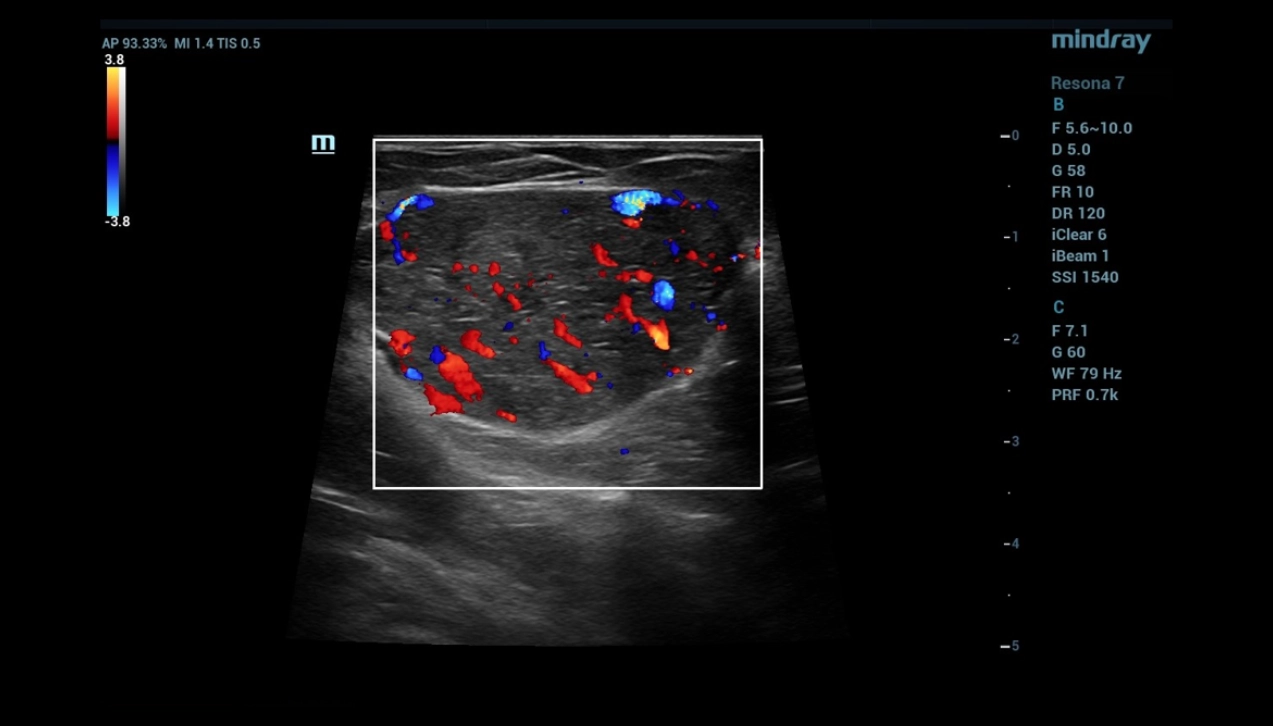 Unleashing The Potential Of Multi Parametric Imaging Mindray