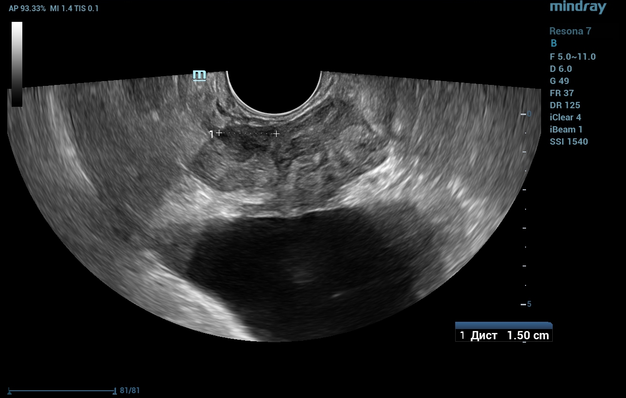 Ultrasound Journal 8 An Example Of The Use Of Multiparametric