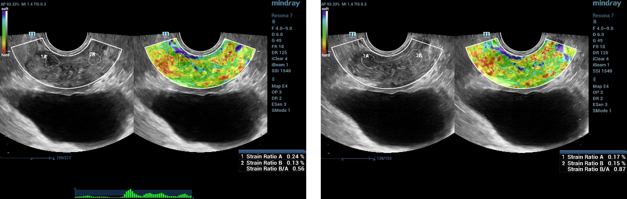 Ultrasound Journal 8 An Example Of The Use Of Multiparametric