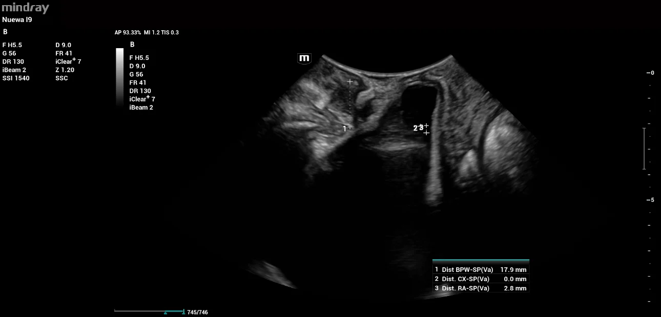 Ultrasound Journal 29 Pelvic Floor Ultrasound Application In The