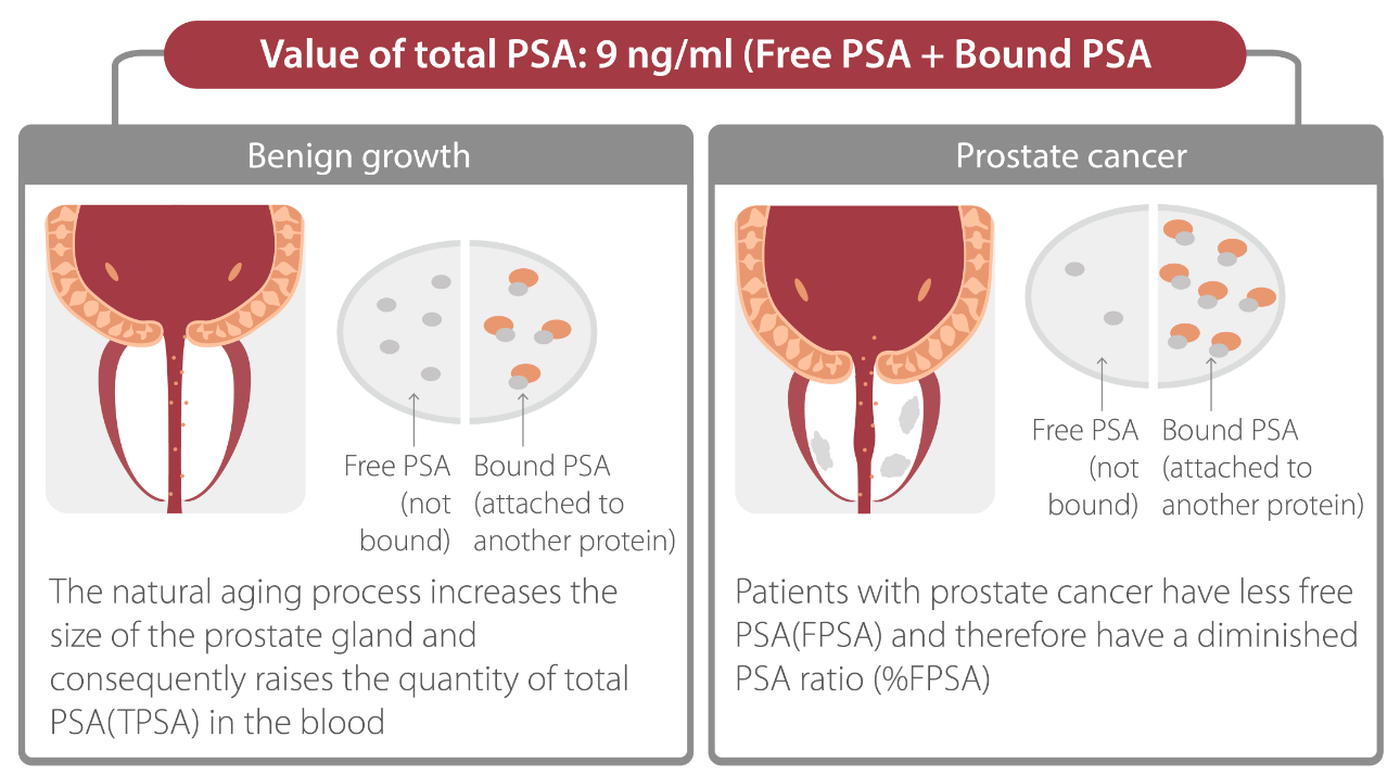 Improving Diagnosis Of Prostate Cancer With Psa Tests Mindray