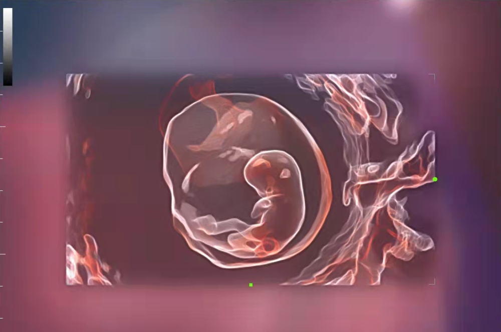 Asset download - Mindray