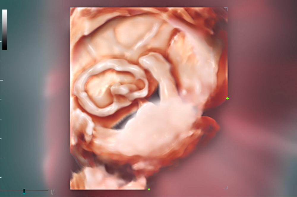 Asset download - Mindray