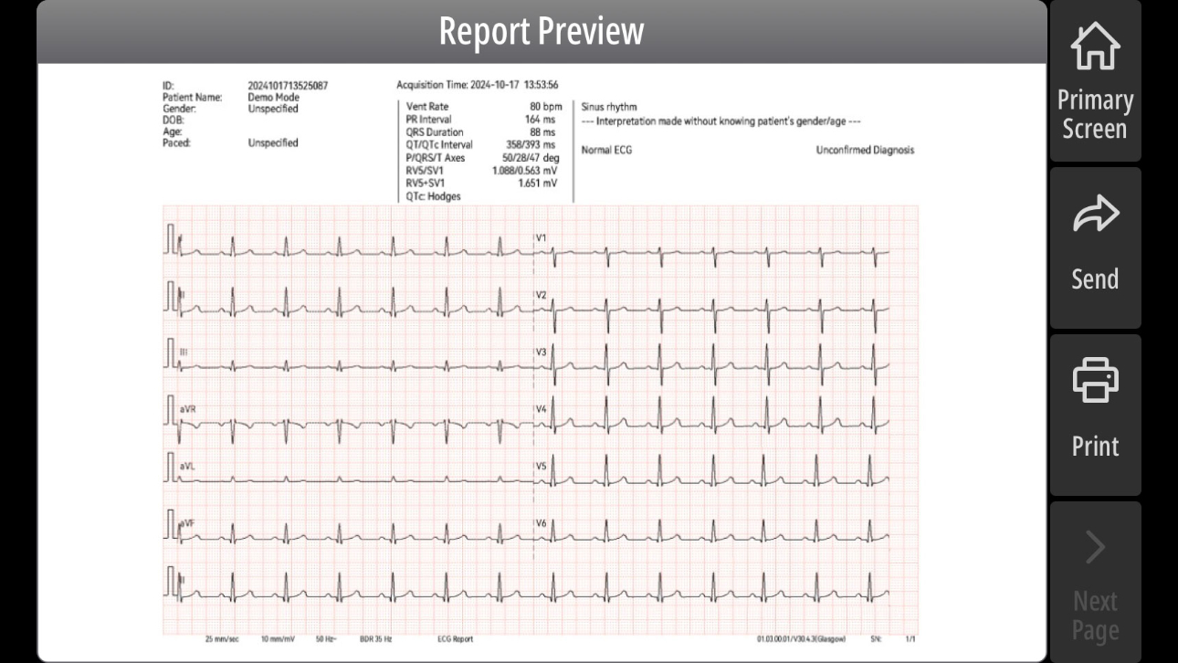 BeneHeart R300 Electrocardiograph - Mindray
