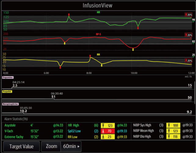 BeneFusion n Series - Infusion Pump - Mindray