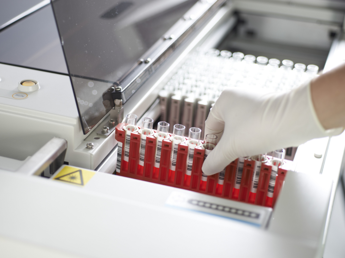 SAL 9000 Chemistry & Immunoassay Integrated System - Mindray