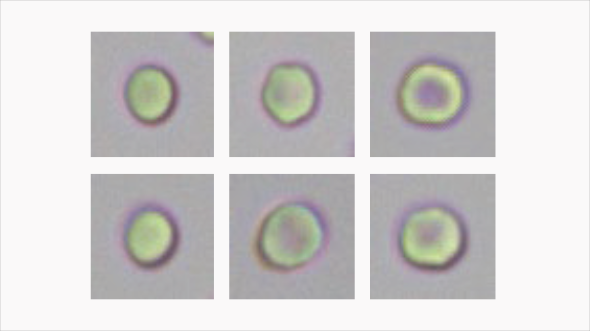 Asset download - Mindray