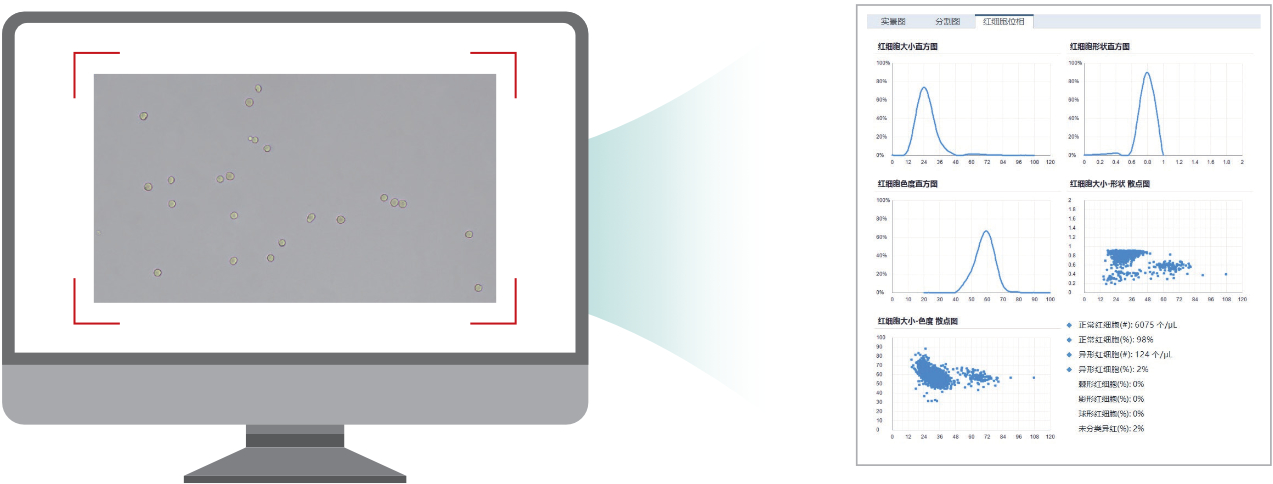 EH-2090 - Auto Urine Sediment Analyzer - Mindray Global