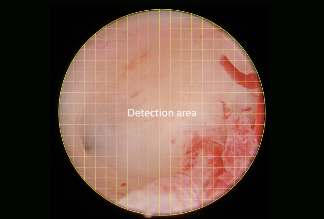 UX1 Series Endoscope Camera System - Mindray