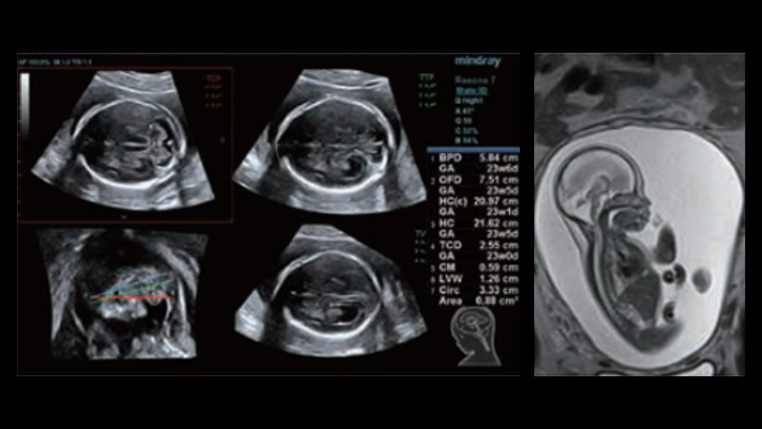 Resona 7 - Mindray Global