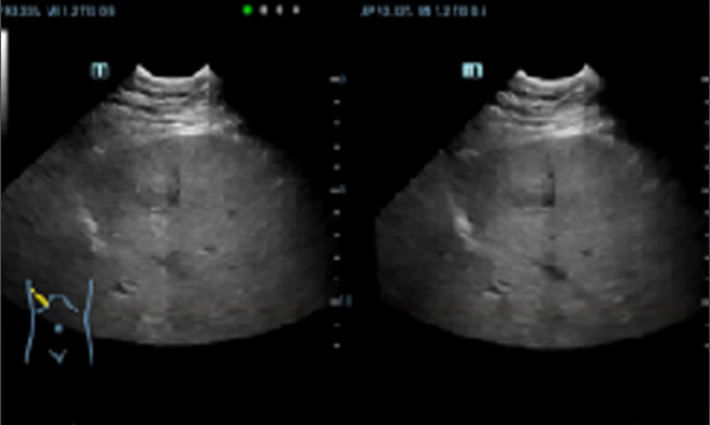 Resona R9 - Premium Ultrsound Systems for Radiology - Mindray
