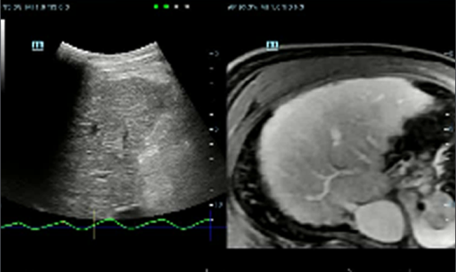 Resona R9 - Premium Ultrsound Systems for Radiology - Mindray