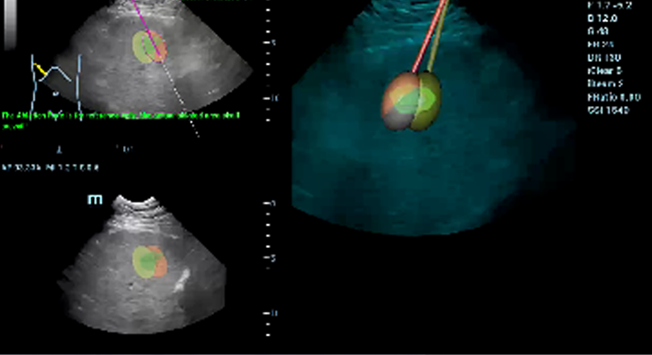 Resona R9 - Premium Ultrsound Systems for Radiology - Mindray