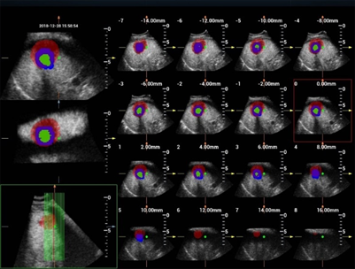 Resona R9 - Premium Ultrsound Systems for Radiology - Mindray