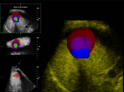 Resona R9 - Premium Ultrsound Systems for Radiology - Mindray