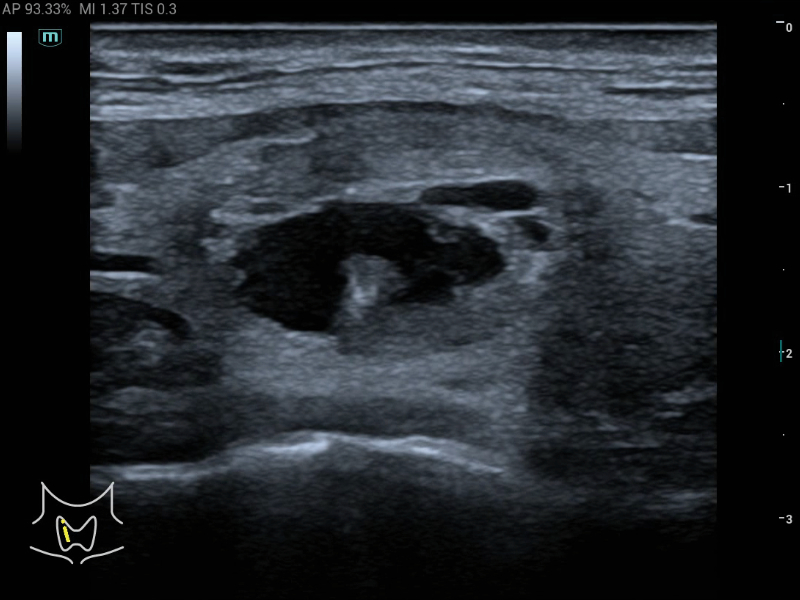 MX3 Compact Ultrasound System - Mindray