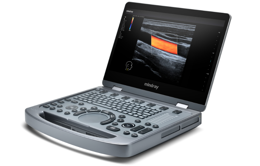 MX3 Compact Ultrasound System - Mindray
