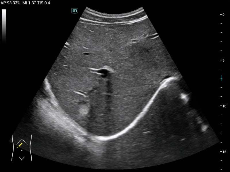 MX5 Compact Ultrasound System - Mindray