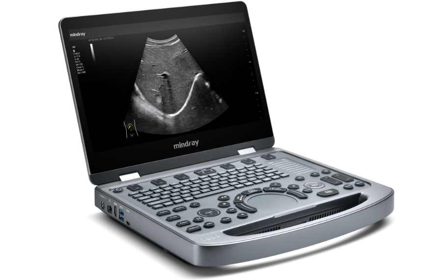 MX5 Compact Ultrasound System - Mindray