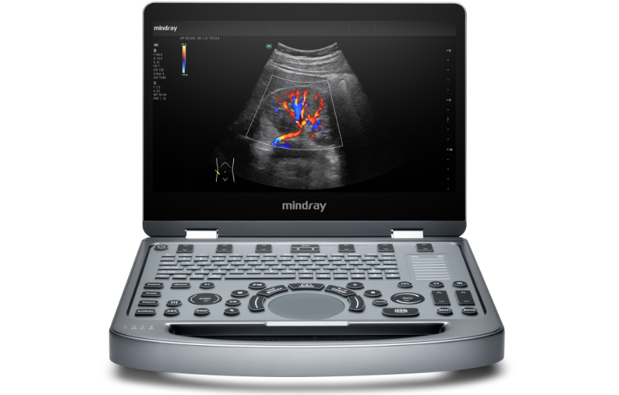 MX6 Compact Ultrasound System - Mindray