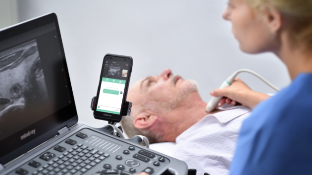 MX6 Compact Ultrasound System - Mindray