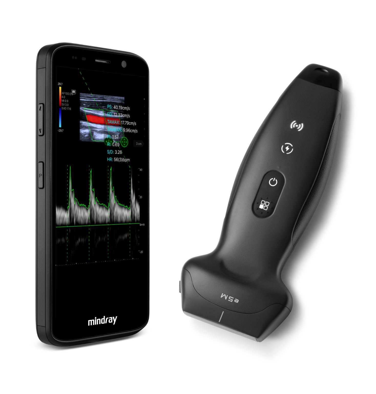 Portable Ultrasound Machines | Mindray