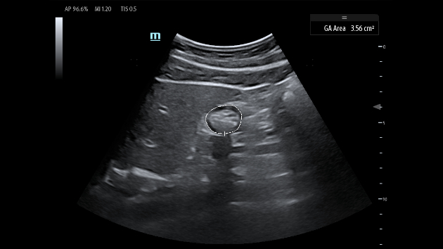 Point of Care Ultrasound System - TEX20 Elite Edition - Mindray Global ...