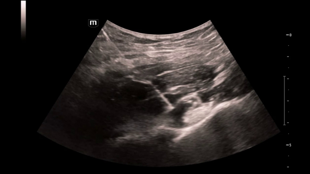 Point of Care Ultrasound System - TEX20 Elite Edition - Mindray Global ...