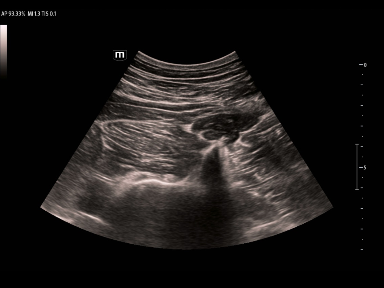 Point of Care Ultrasound System - TEX20 Elite Edition - Mindray Global ...