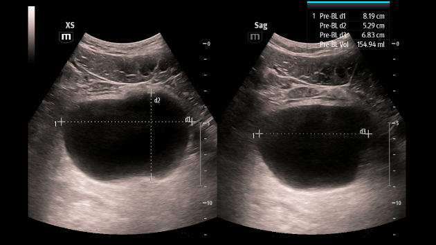 Point of Care Ultrasound System - TEX20 Elite Edition - Mindray Global ...