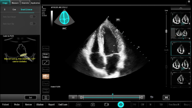 Point of Care Ultrasound System - TEX20 Elite Edition - Mindray Global ...