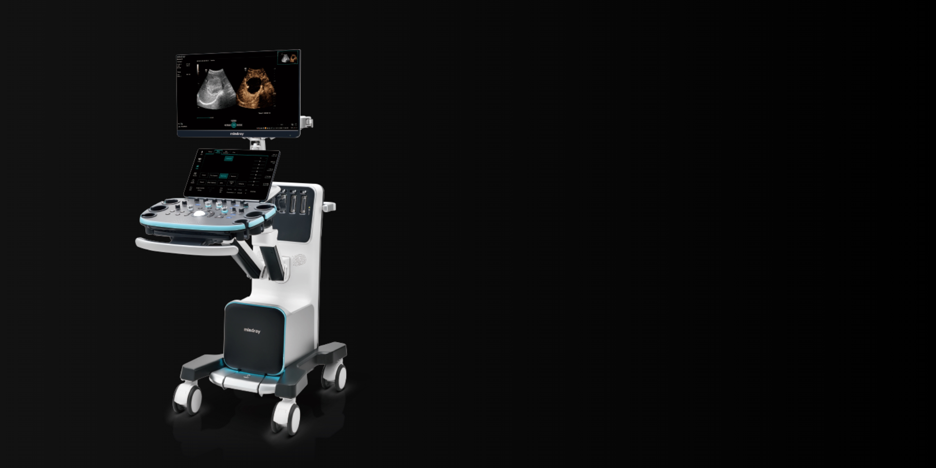 [Official] General Imaging Resona Series - Mindray