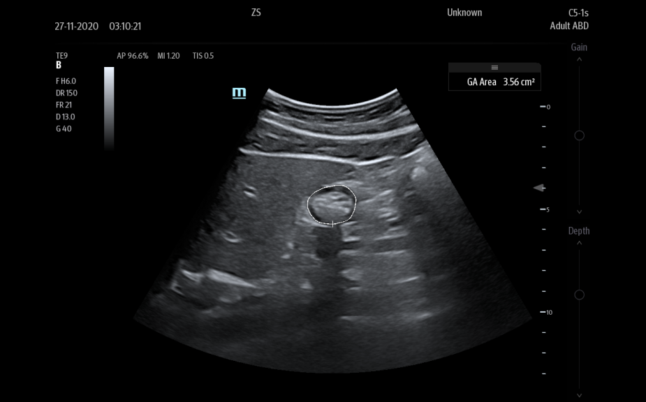 TE9 Ultrasound System - Mindray