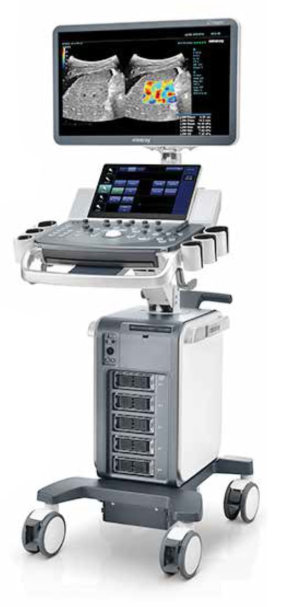 Sonoscan vouches to improve clinical outcome with Mindray’s AI-powered ...