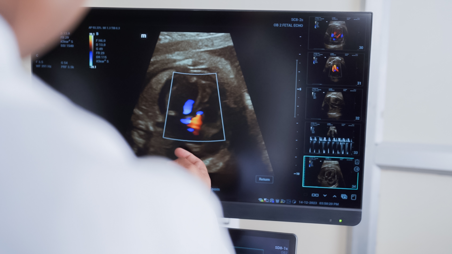 Asset download - Mindray