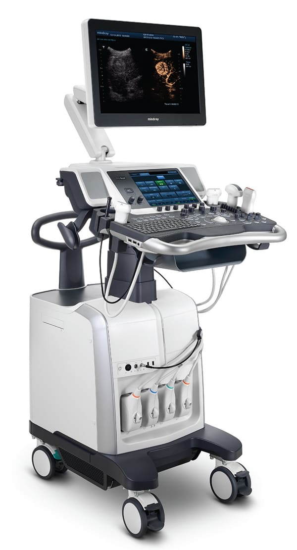 How AI and 4D Imaging will change the future of Ultrasound - Mindray India