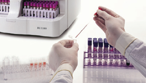 BC-5380 | 5-Diff Hematology Devices | Mindray India - Mindray India