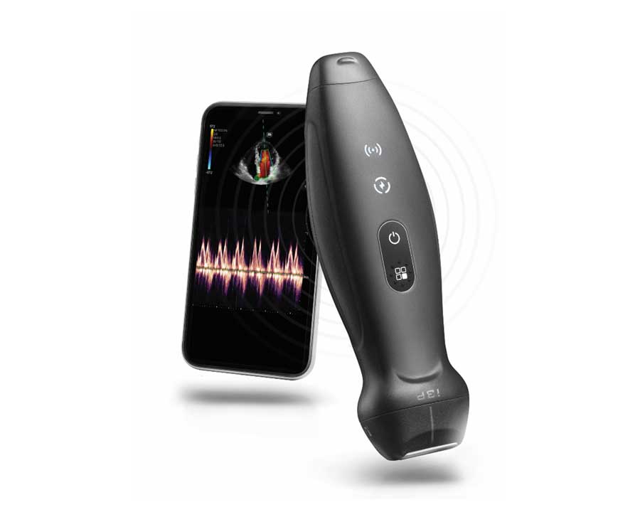 Echocardiography: Driving Better Patient Care in Cardiology Practices