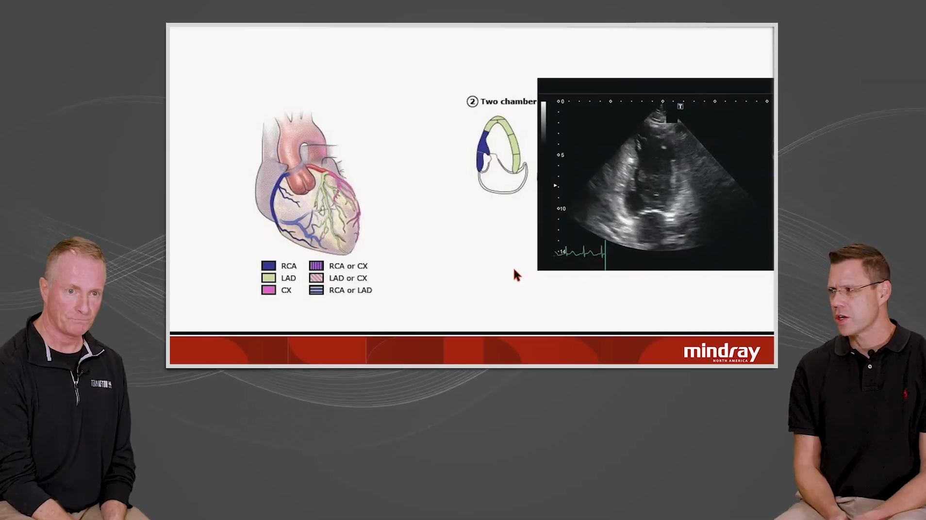 Advanced Cardiac POCUS Webinar Series
