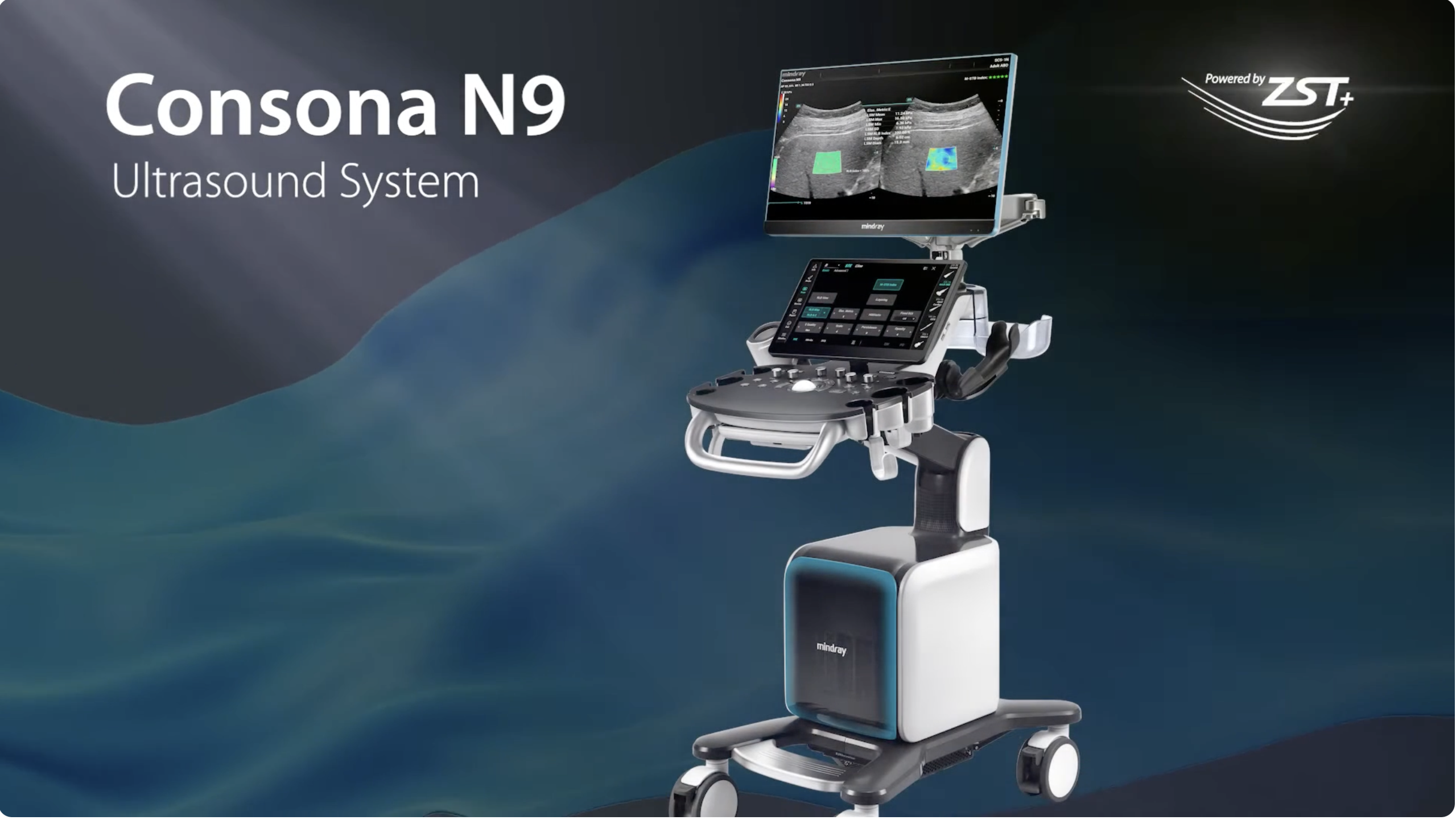Mindray Strengthens its Office-based Ultrasound Machine Portfolio ...