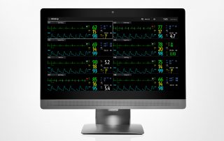 BeneVision Distributed Monitoring System (DMS)