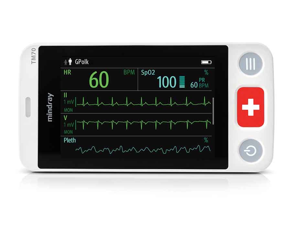 BeneVision TM70 Patient Monitor - Display Telemetry Transmitter