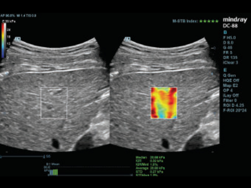 Asset download - Mindray