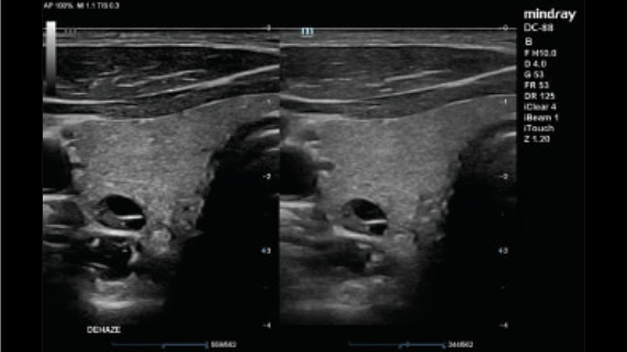 Asset download - Mindray